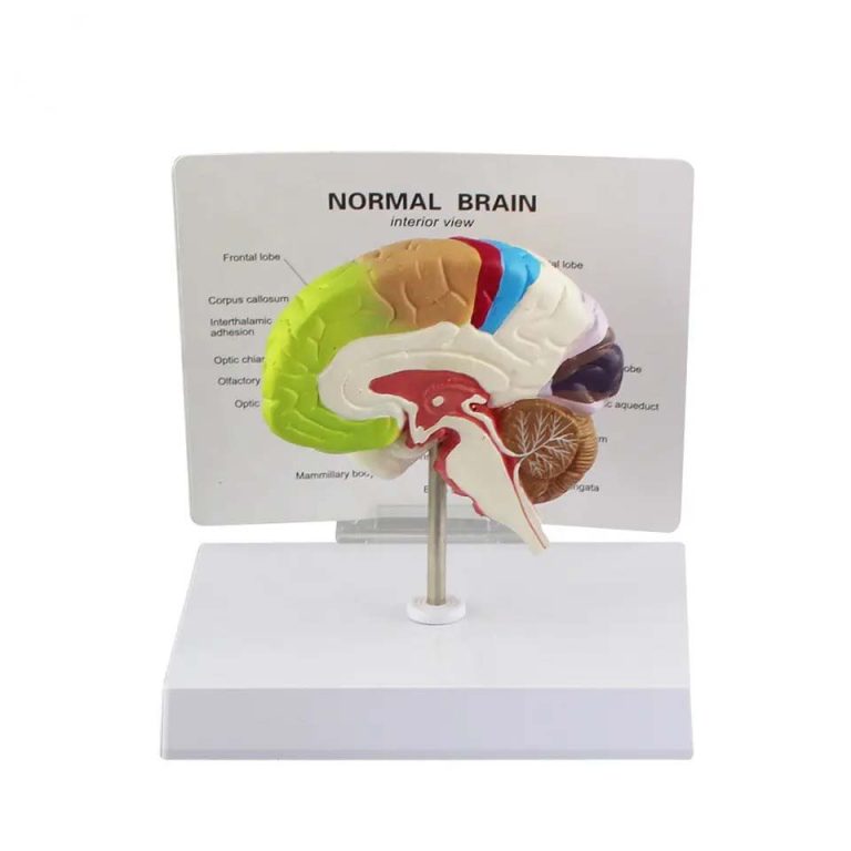 Colored Brain Model Ι Educational Brain Anatomy Model - Techno Health