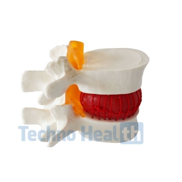 Human Cervical Lumbar Spine Vertebral 3d Model - Techno Health